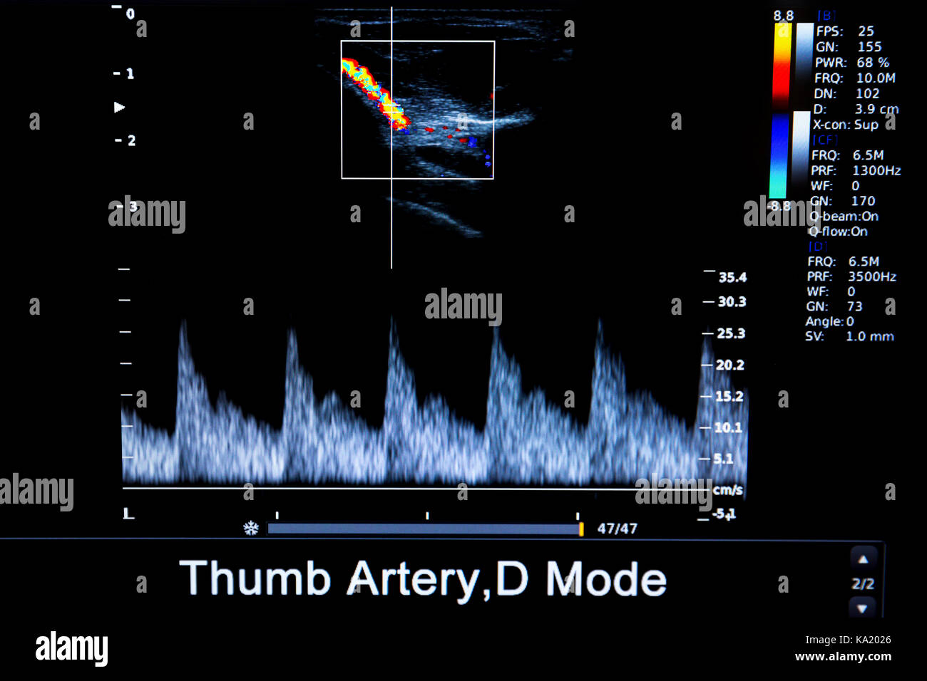 Colourful image of modern ultrasound monitor. Ultrasonography machine ...
