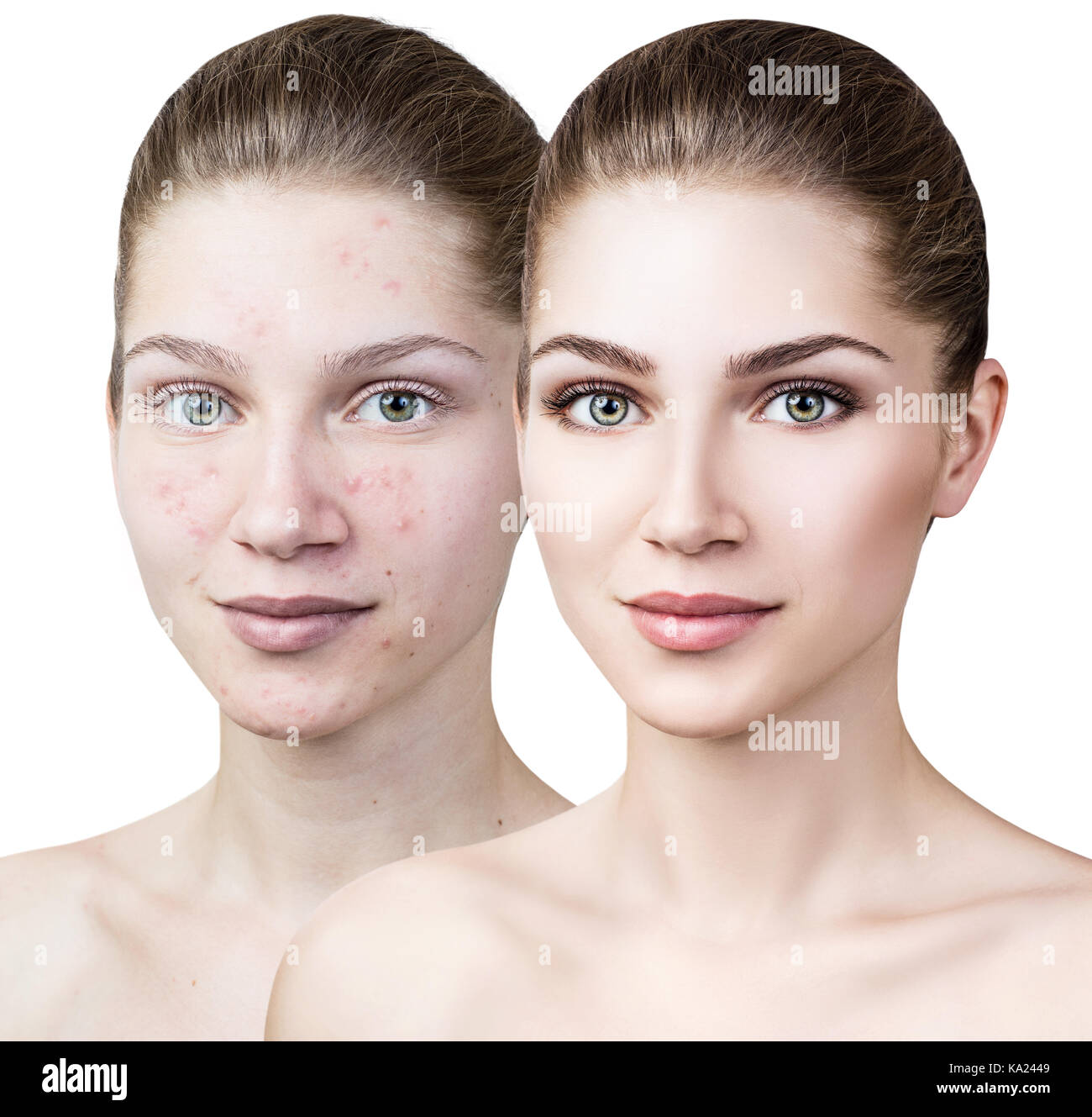 Young woman without and with makeup Stock Photo - Alamy