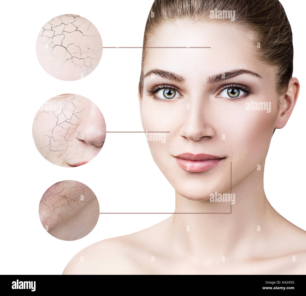 Zoom circle shows facial skin before moistening Stock Photo - Alamy