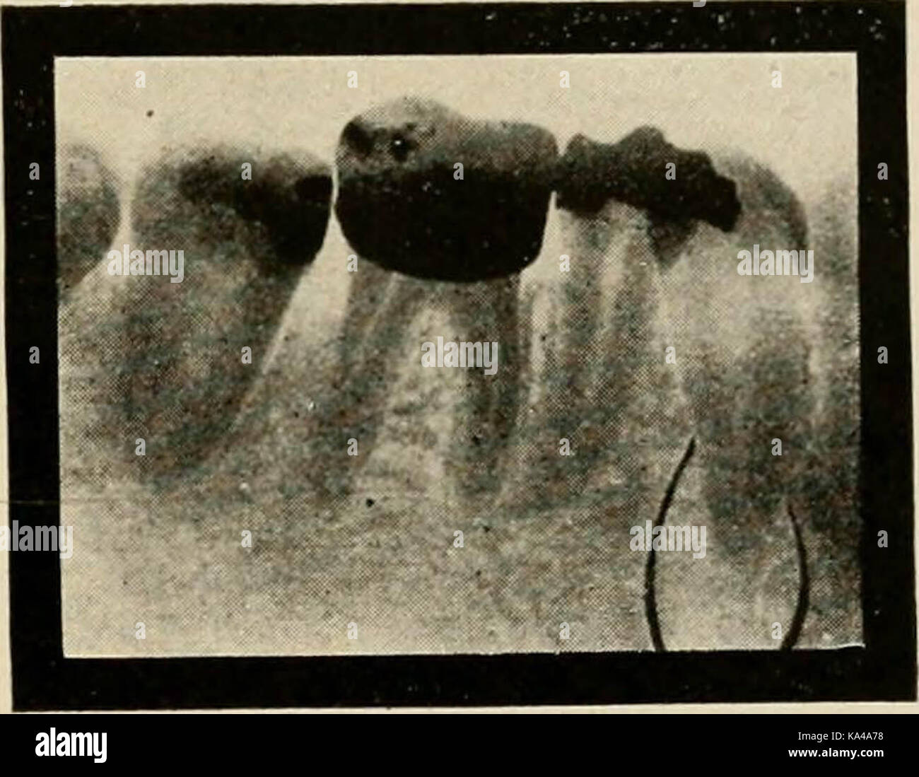 "Elementary and dental radiography / by Howard Riley Raper" (1918 Stock ...
