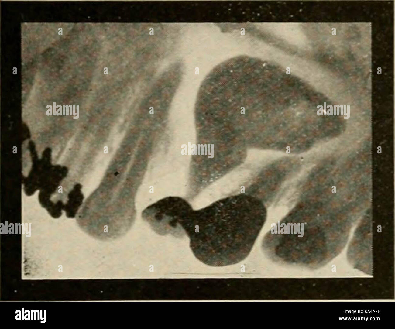 "Elementary and dental radiography / by Howard Riley Raper" (1918 Stock ...