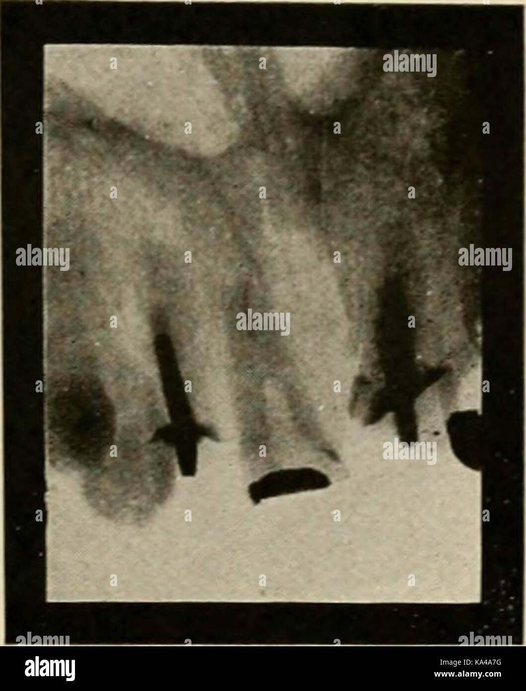 "Elementary and dental radiography / by Howard Riley Raper" (1918 Stock ...