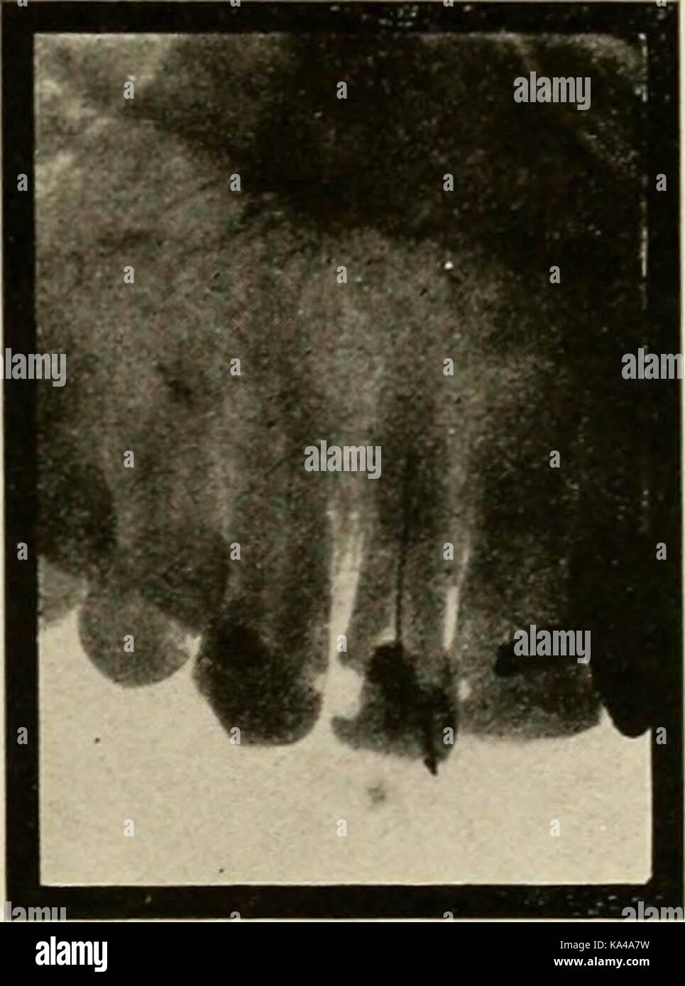 "Elementary and dental radiography / by Howard Riley Raper" (1918 Stock ...