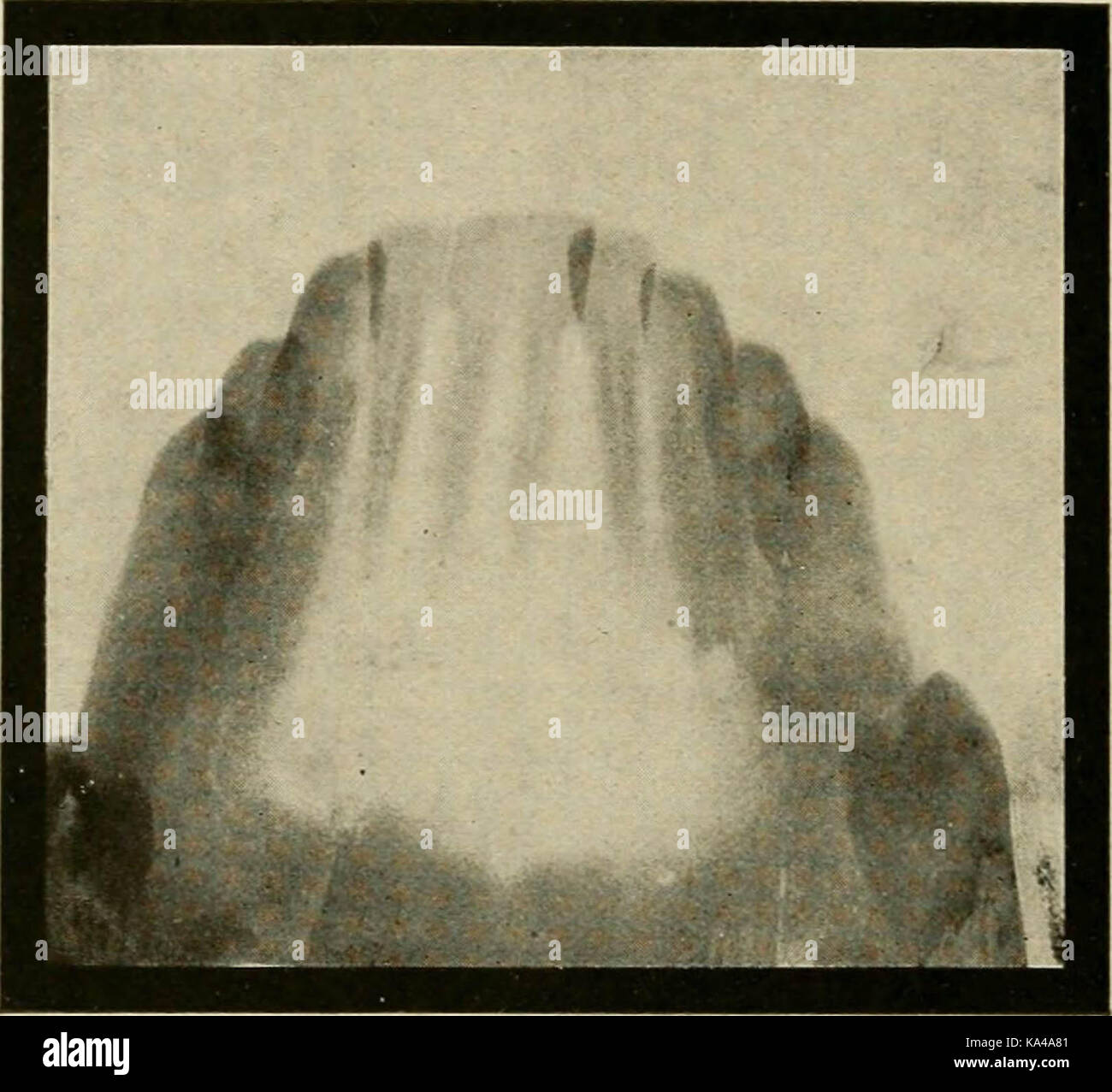 "Elementary and dental radiography / by Howard Riley Raper" (1918 Stock ...