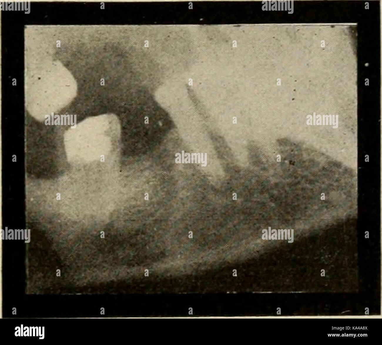 Radiography historical hi-res stock photography and images - Alamy
