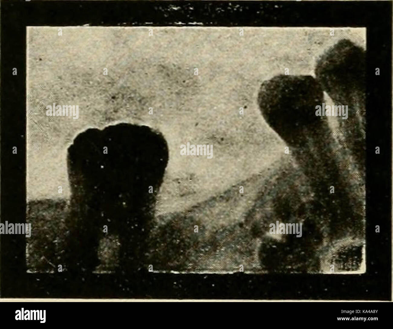 "Elementary and dental radiography / by Howard Riley Raper" (1918 Stock ...