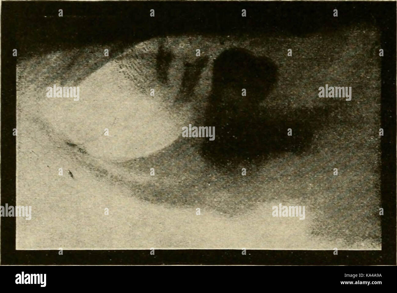 Radiography historical hi-res stock photography and images - Alamy