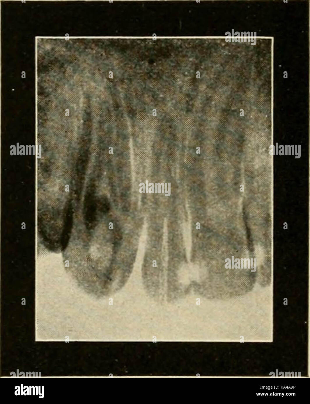 Radiography historical hi-res stock photography and images - Alamy