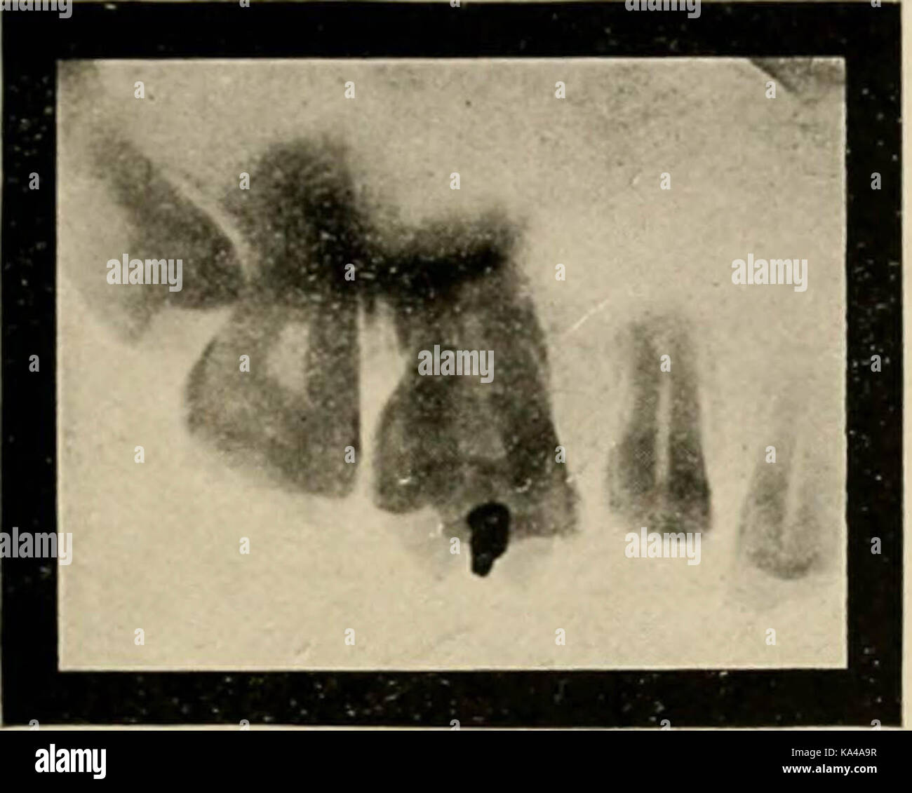 "Elementary and dental radiography / by Howard Riley Raper" (1918 Stock ...