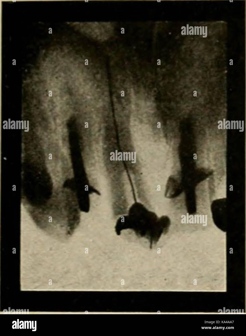 "Elementary and dental radiography / by Howard Riley Raper" (1918 Stock ...