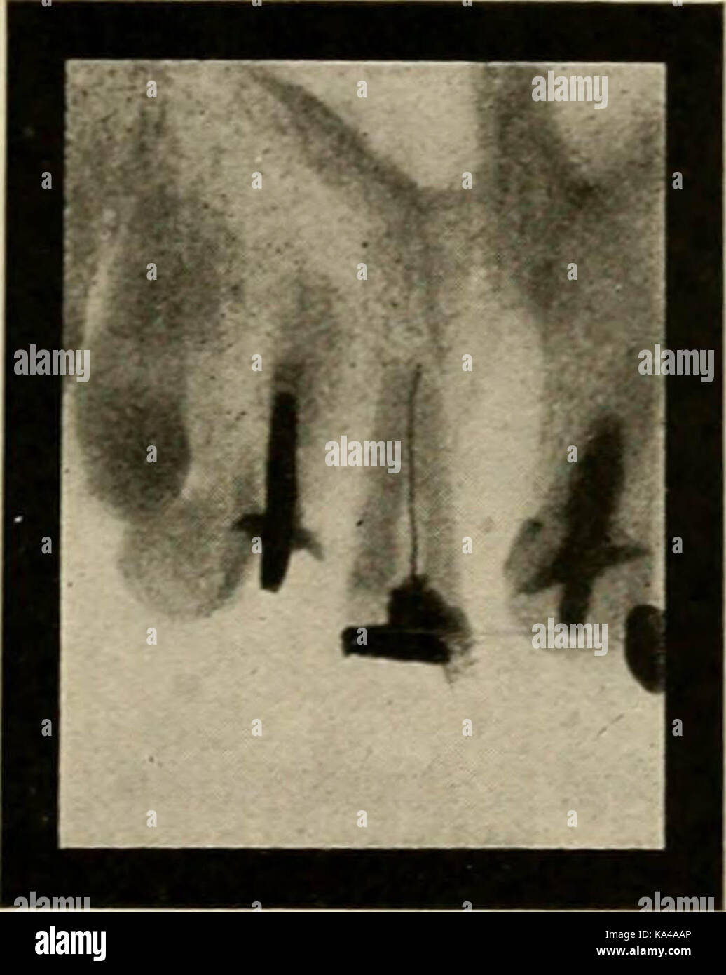 "Elementary and dental radiography / by Howard Riley Raper" (1918 Stock ...