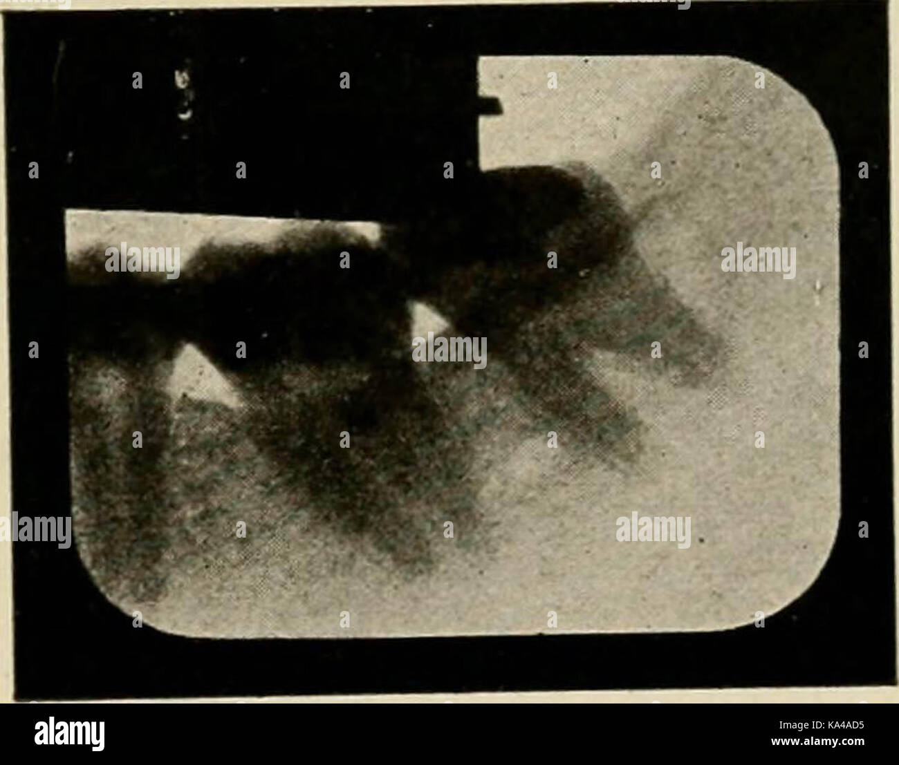"Elementary and dental radiography / by Howard Riley Raper" (1918 Stock ...