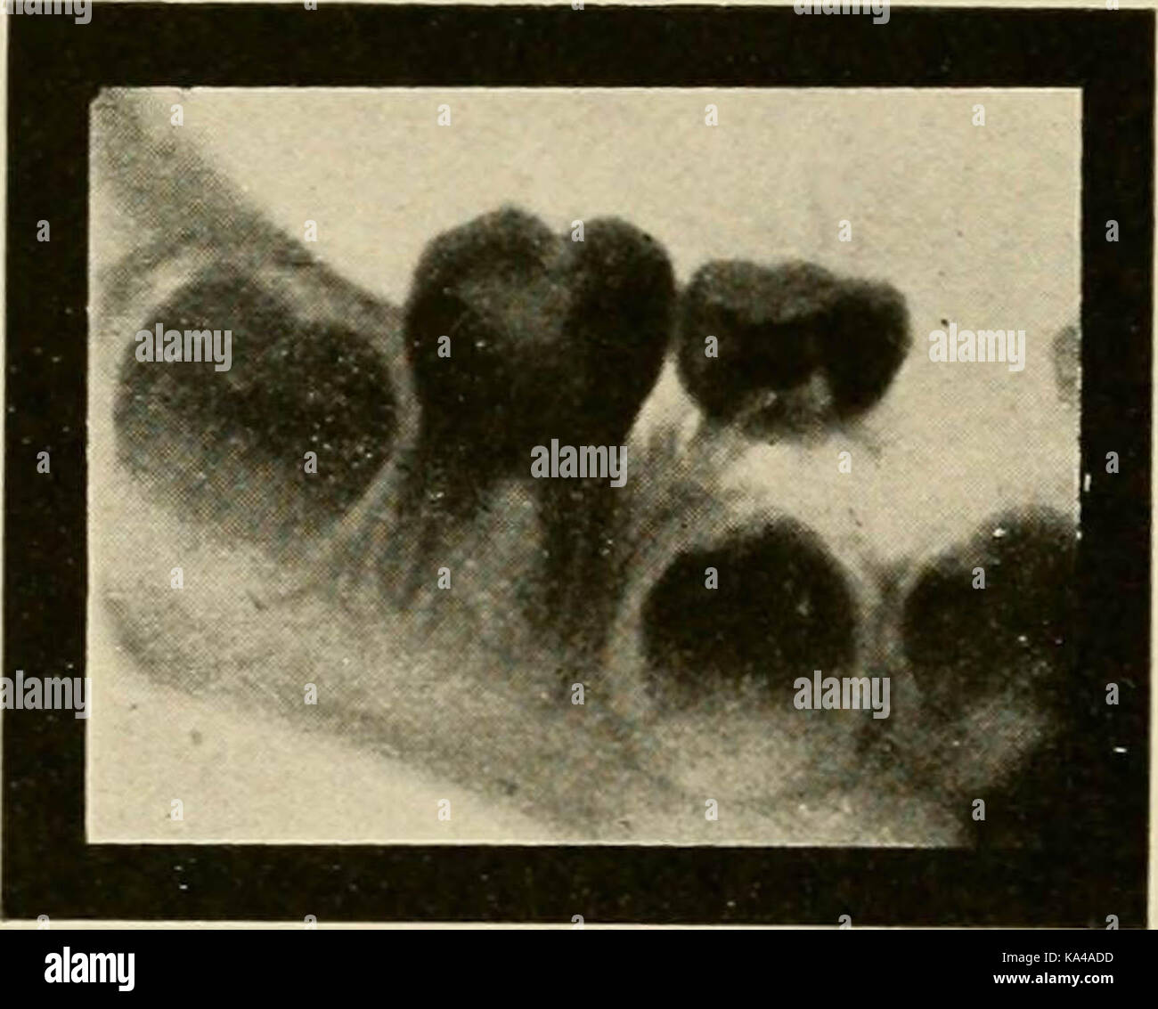 "Elementary and dental radiography / by Howard Riley Raper" (1918 Stock ...