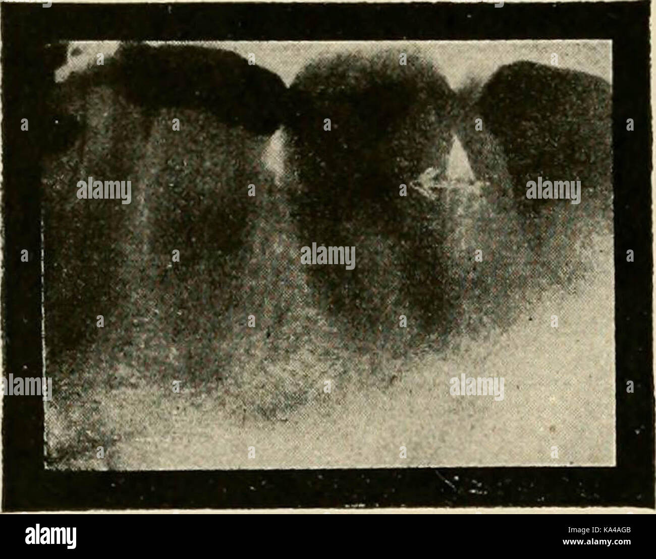 "Elementary and dental radiography / by Howard Riley Raper" (1918 Stock ...