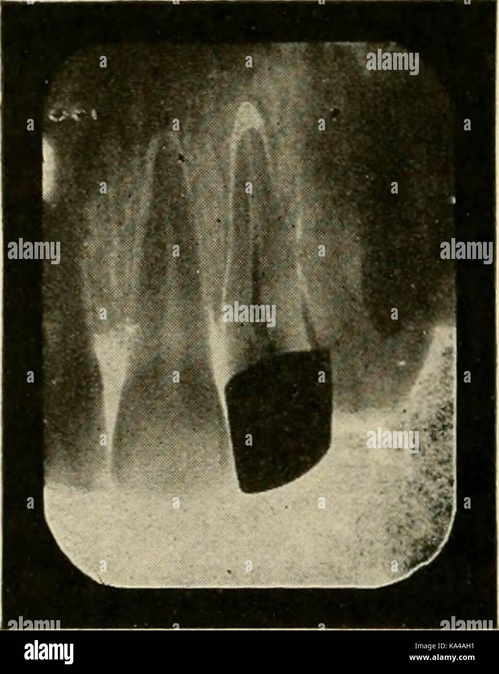Elementary and dental radiography by howard riley raper 1918 hi-res ...