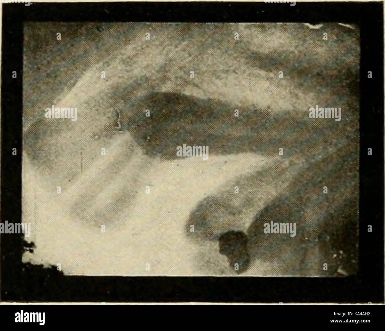 "Elementary and dental radiography / by Howard Riley Raper" (1918 Stock ...