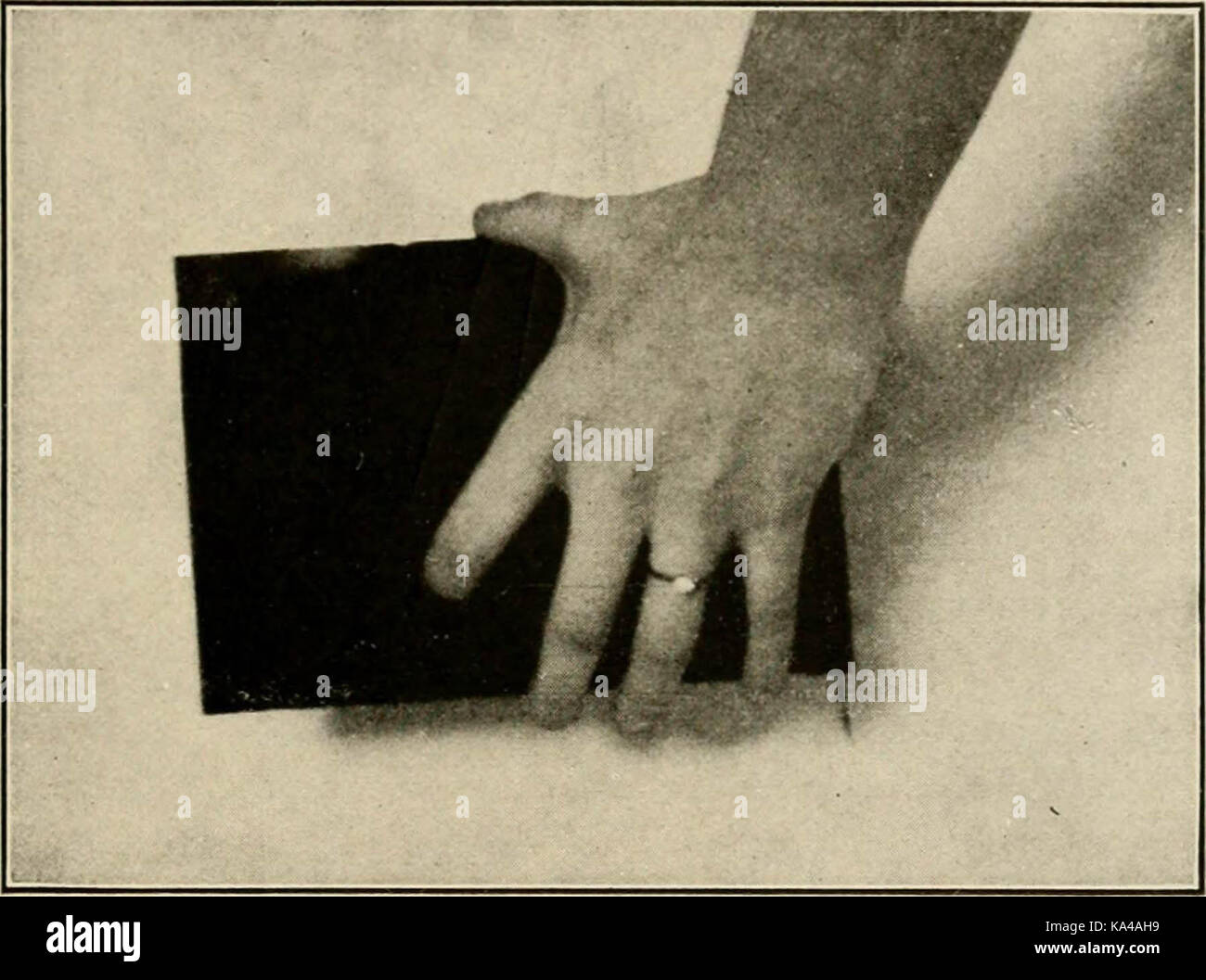 "Elementary and dental radiography / by Howard Riley Raper" (1918 Stock ...