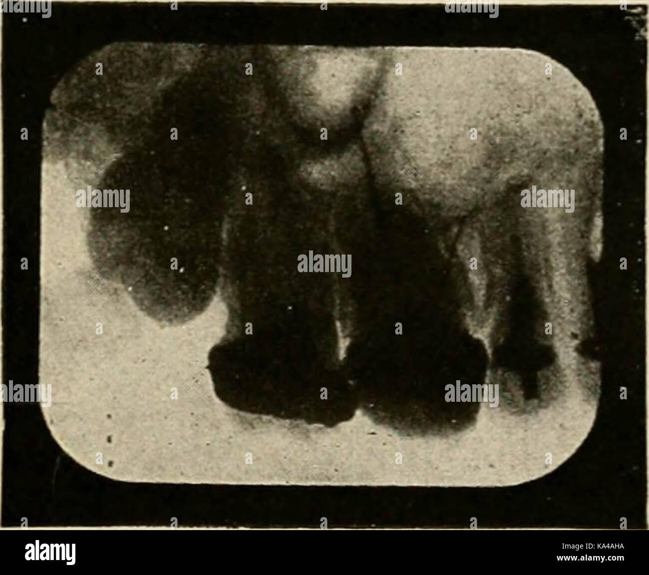 Elementary and dental radiography by howard riley raper 1918 hi-res ...