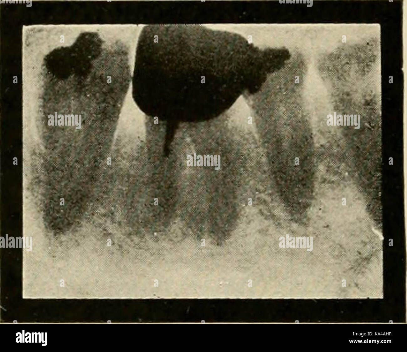 "Elementary and dental radiography / by Howard Riley Raper" (1918 Stock ...