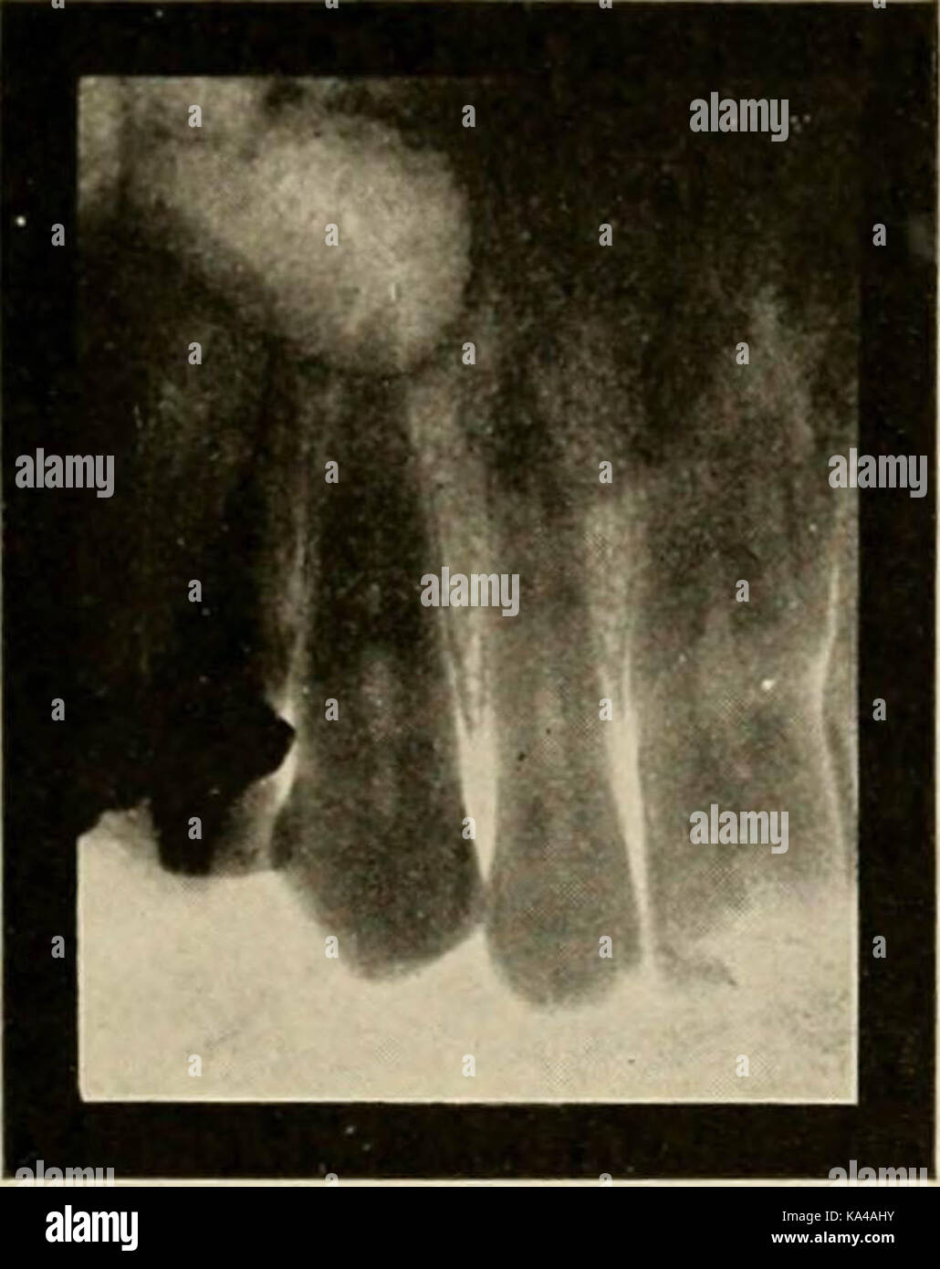 "Elementary and dental radiography / by Howard Riley Raper" (1918 Stock ...