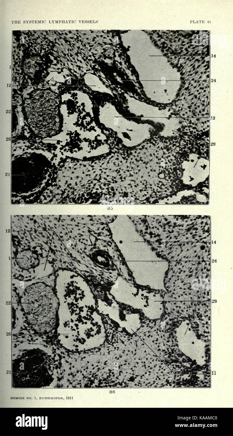 The anatomy and development of the systemic lymphatic vessels in the ...