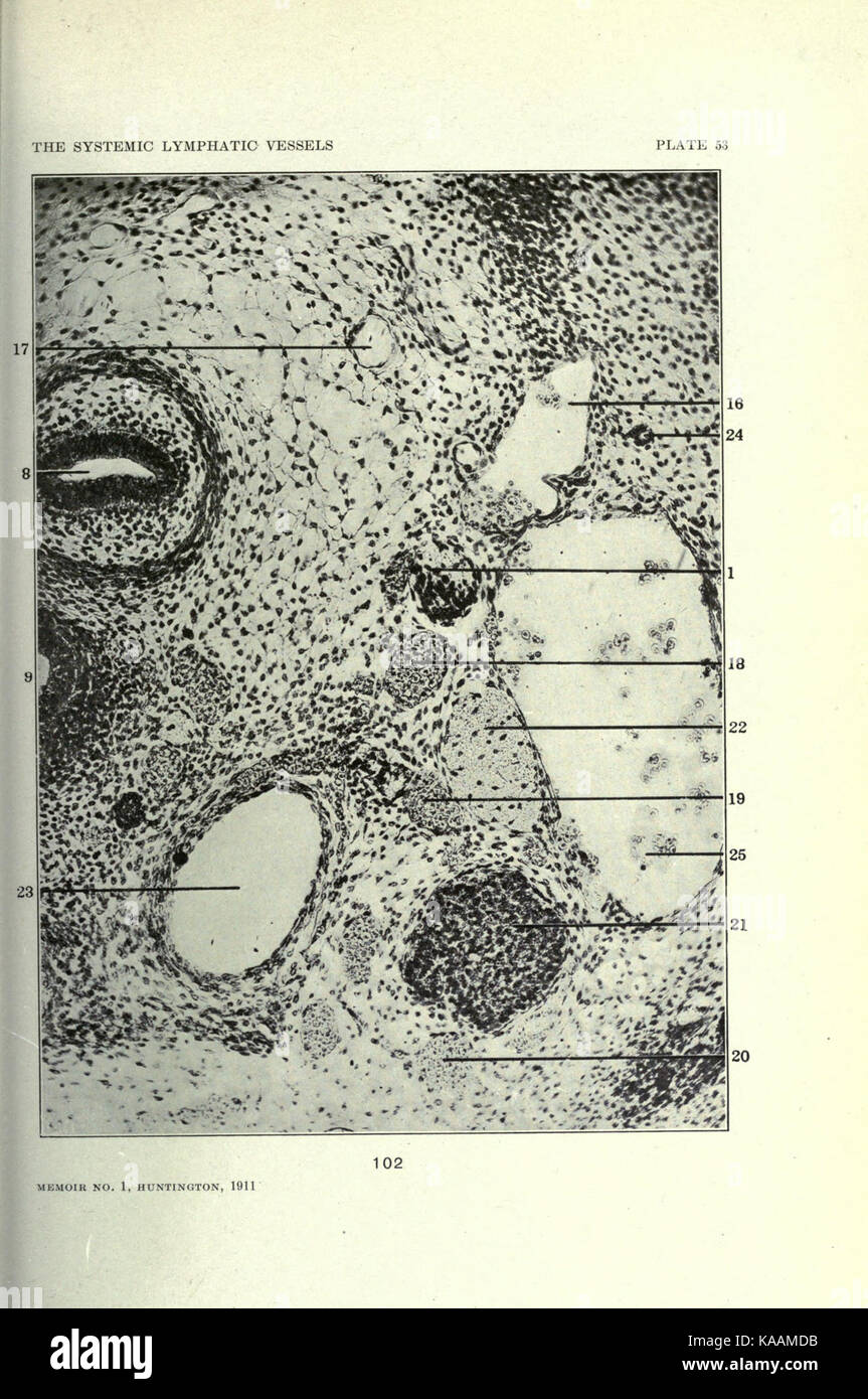 The anatomy and development of the systemic lymphatic vessels in the ...