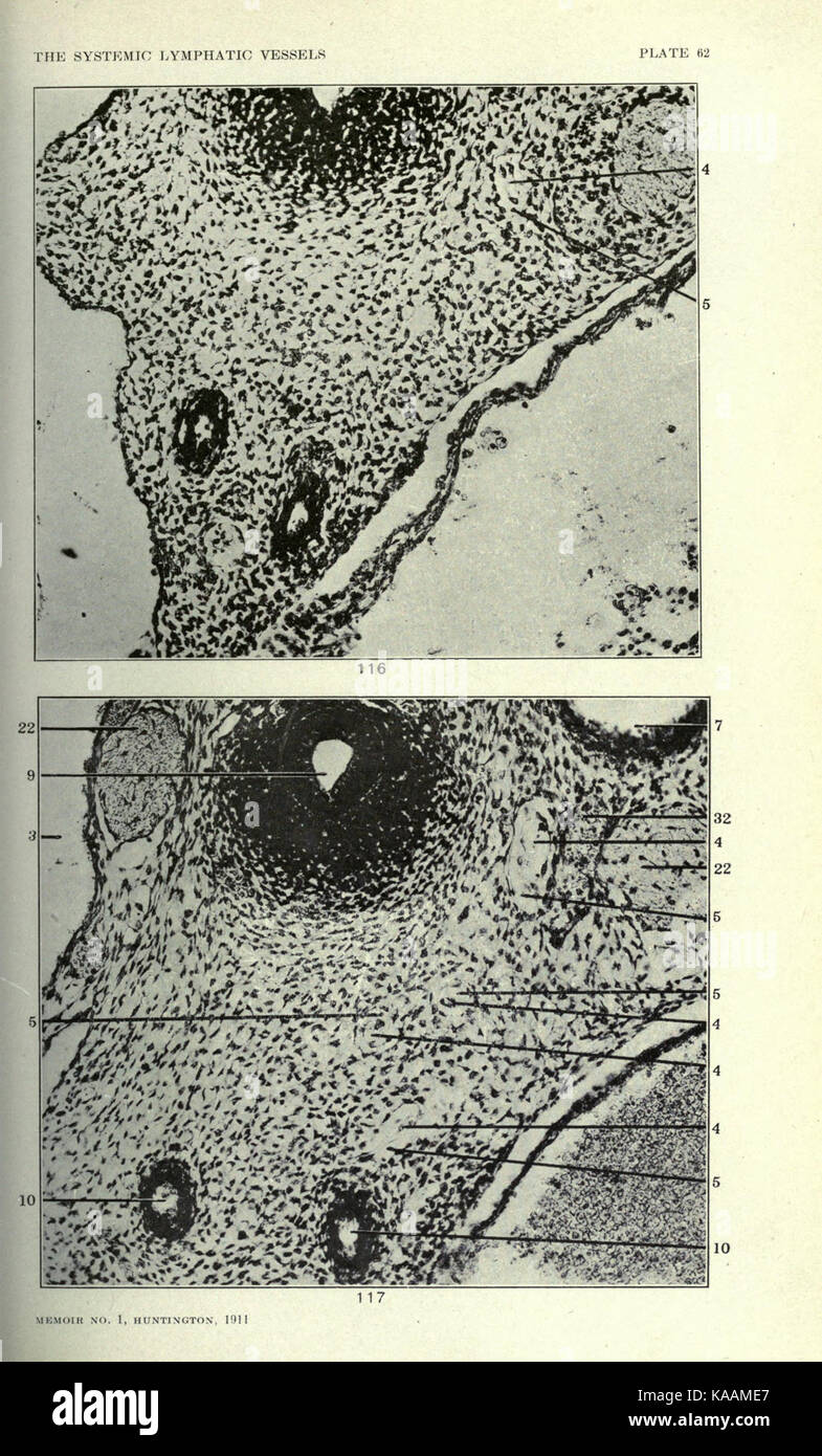 The anatomy and development of the systemic lymphatic vessels in the ...