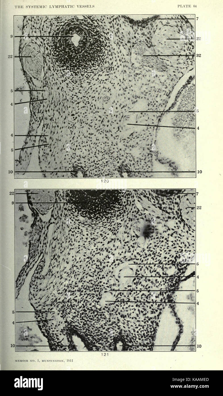 The anatomy and development of the systemic lymphatic vessels in the ...