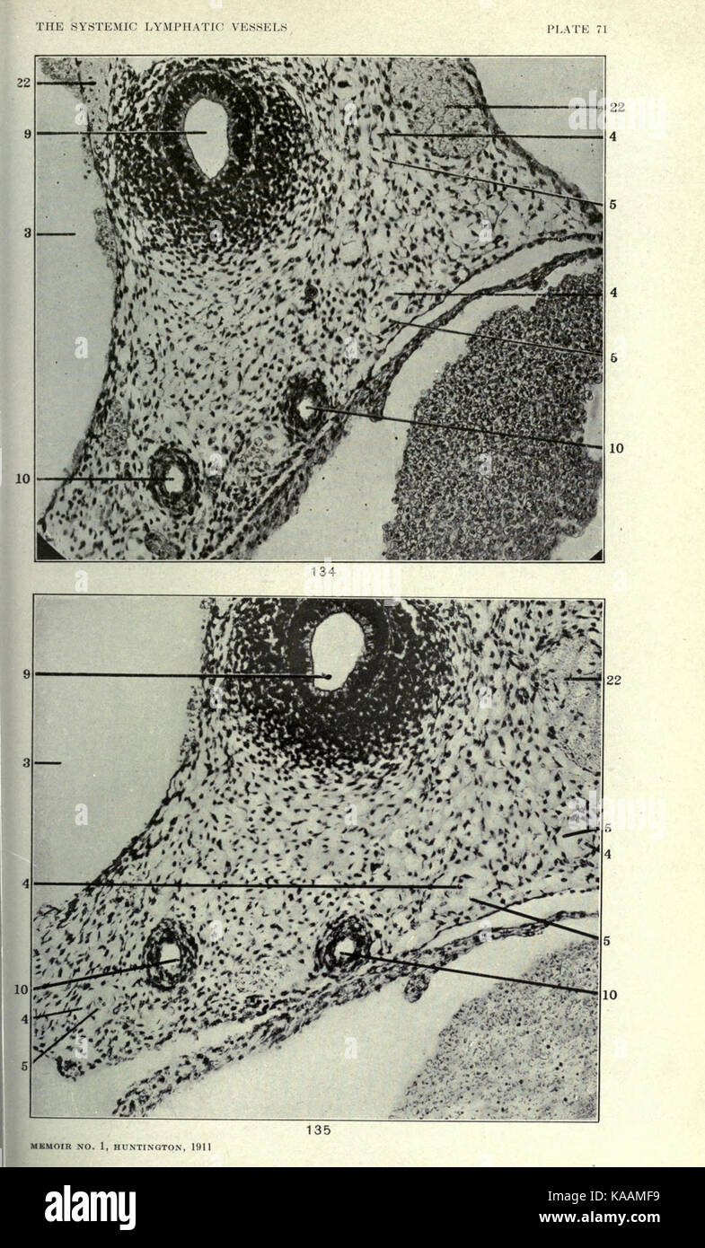 The anatomy and development of the systemic lymphatic vessels in the ...