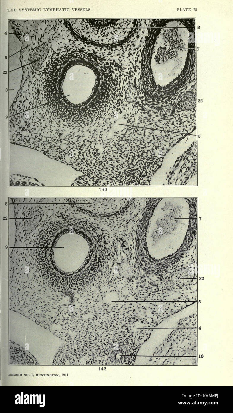 Illustration lymphatic system in hi-res stock photography and images ...