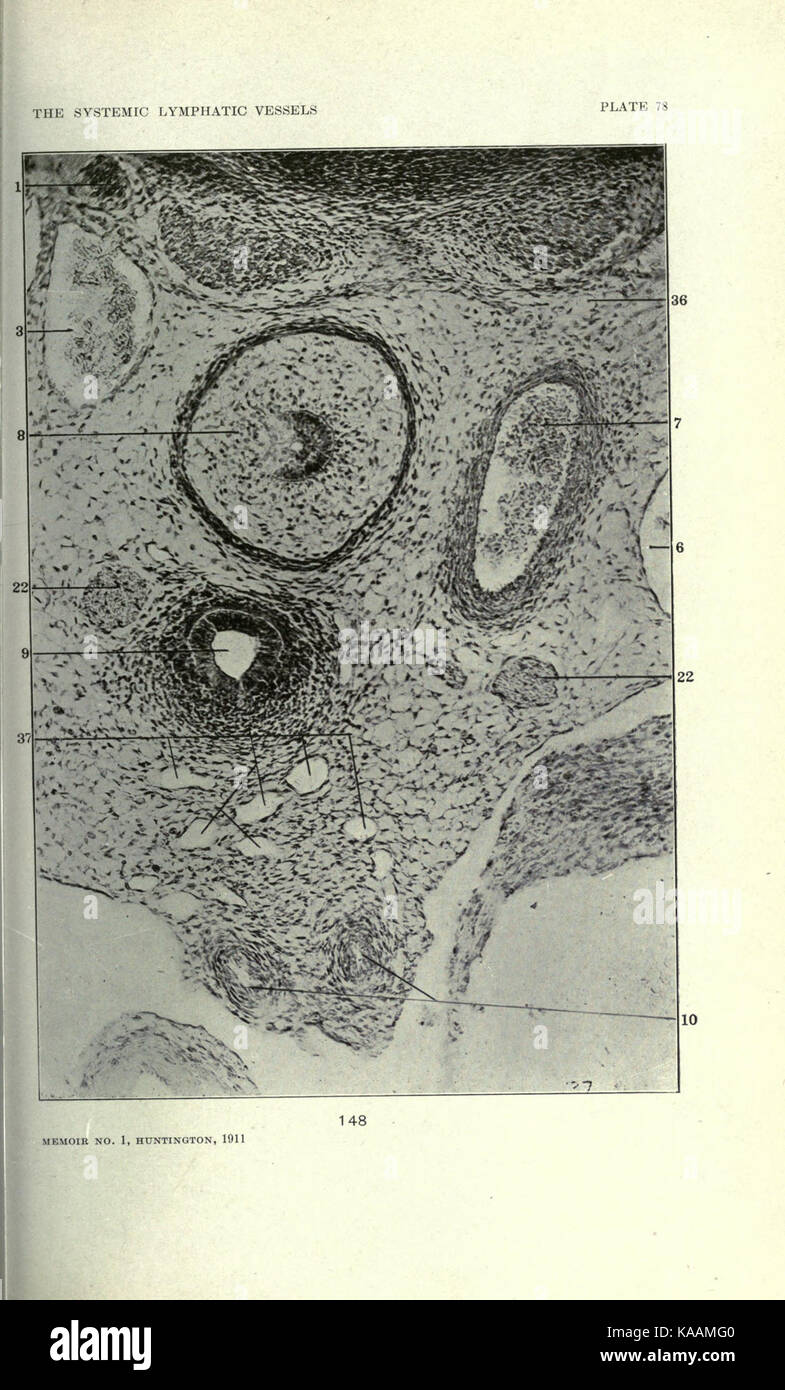 The anatomy and development of the systemic lymphatic vessels in the ...