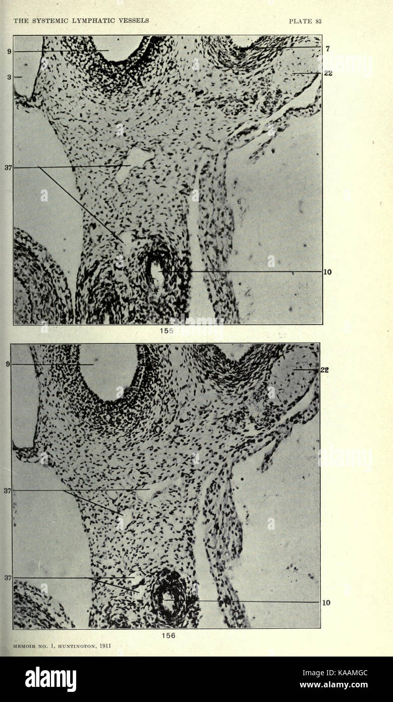 Lymph nodes function hi-res stock photography and images - Alamy