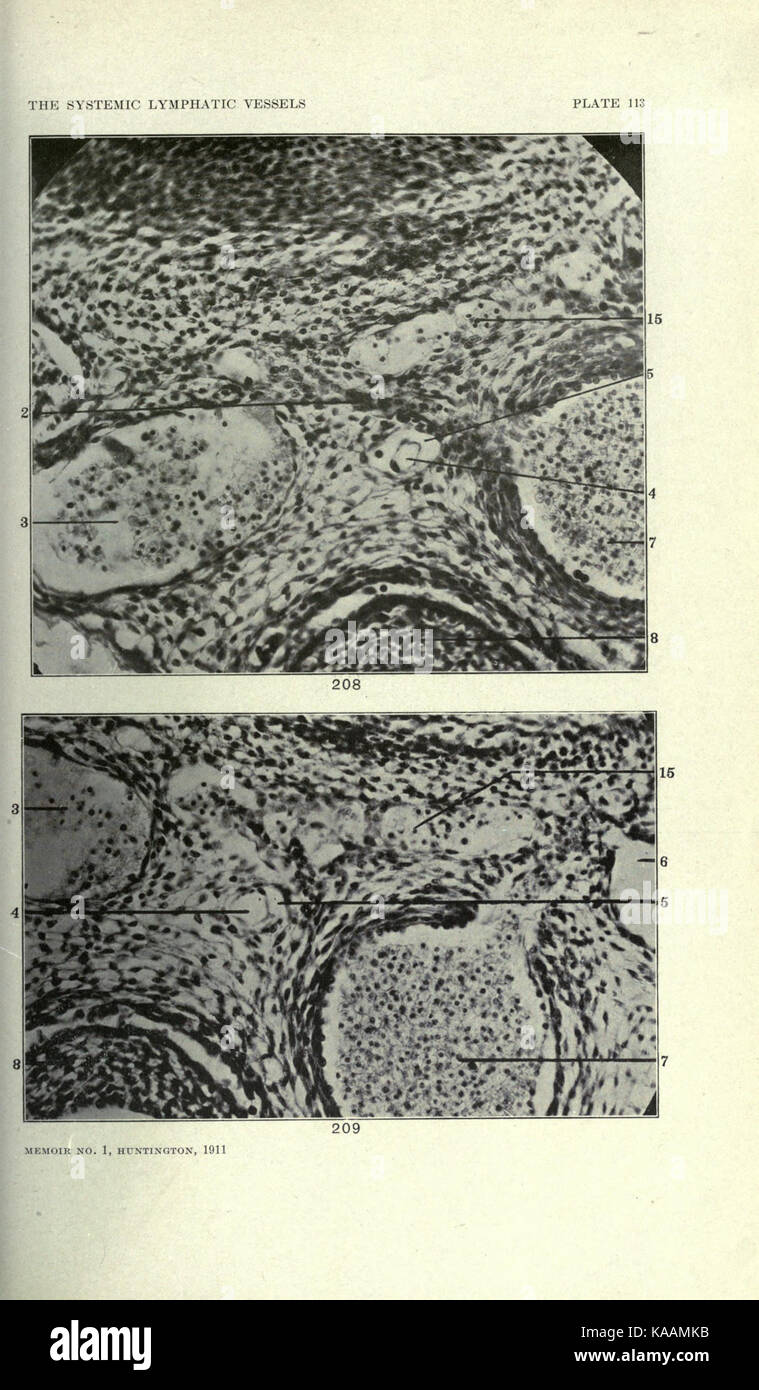 Lymph nodes function hi-res stock photography and images - Alamy