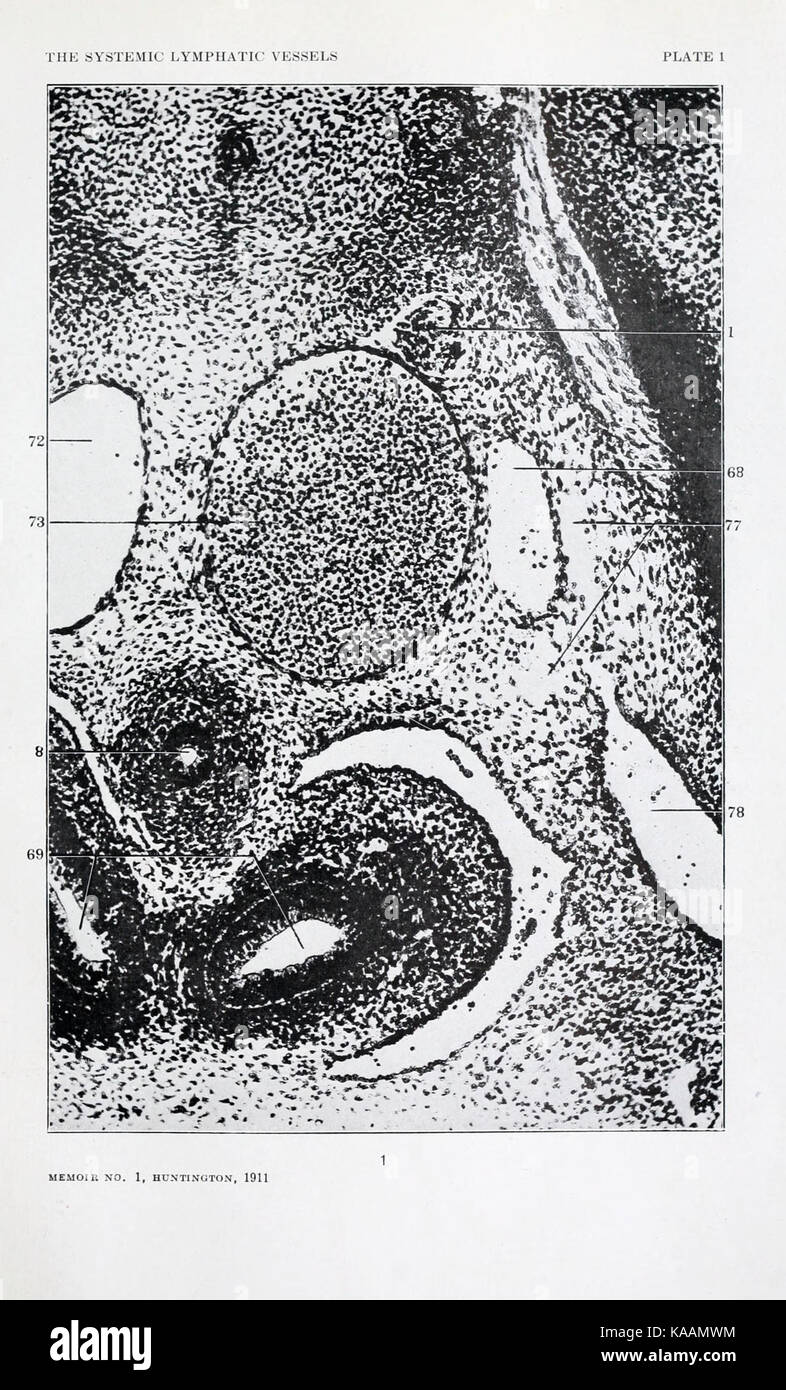 Lymph nodes function hi-res stock photography and images - Alamy