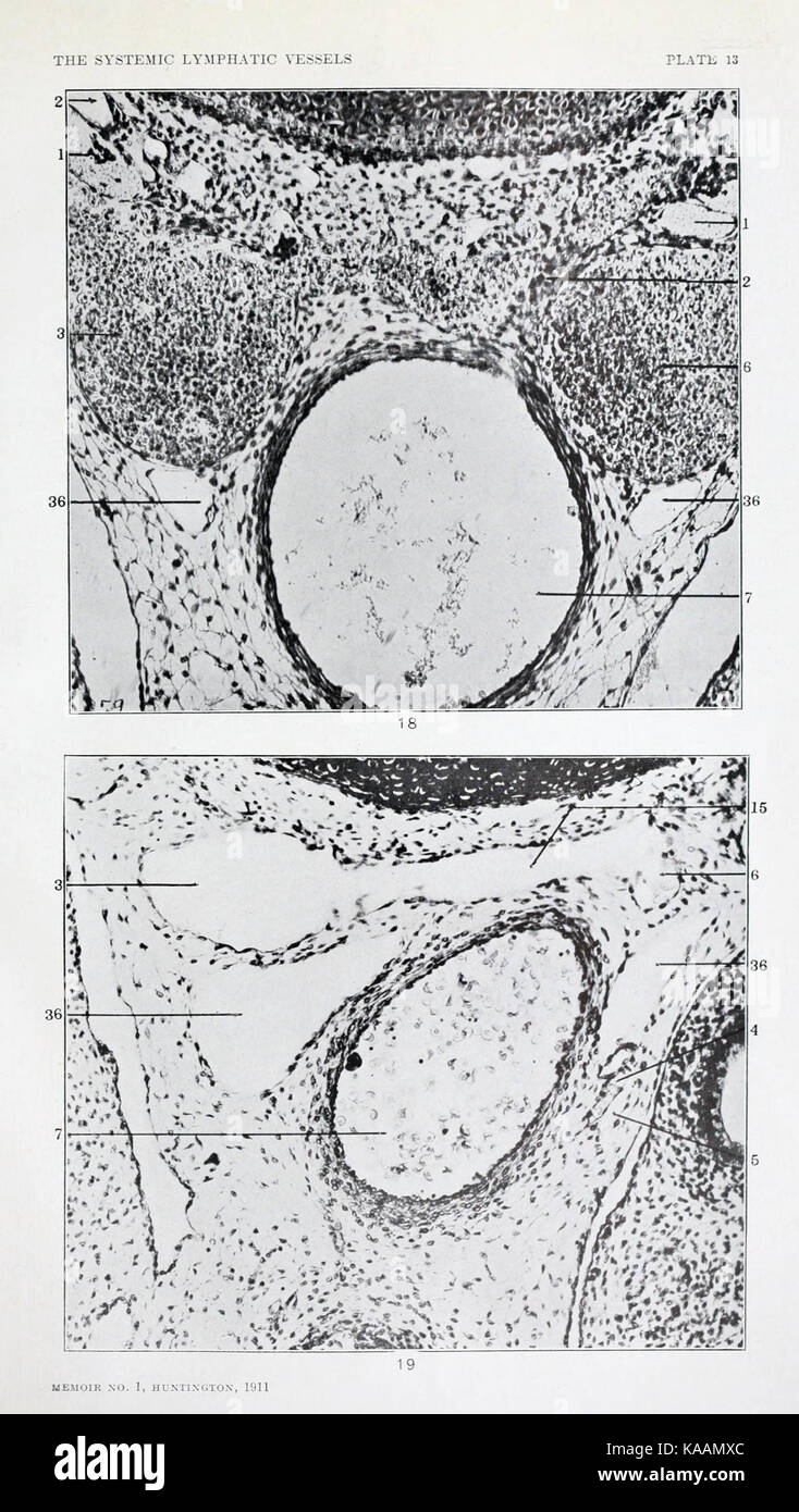 The anatomy and development of the systemic lymphatic vessels in the ...