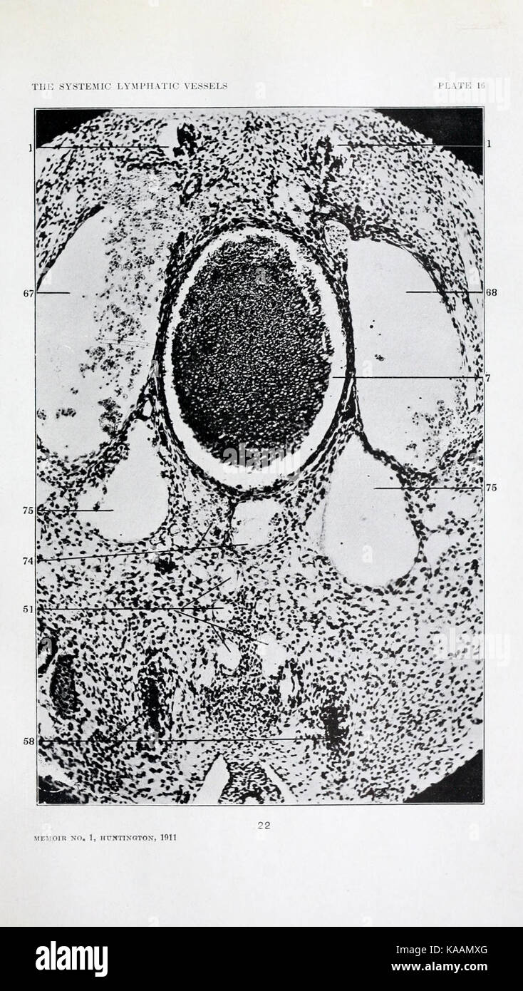 The anatomy and development of the systemic lymphatic vessels in the ...