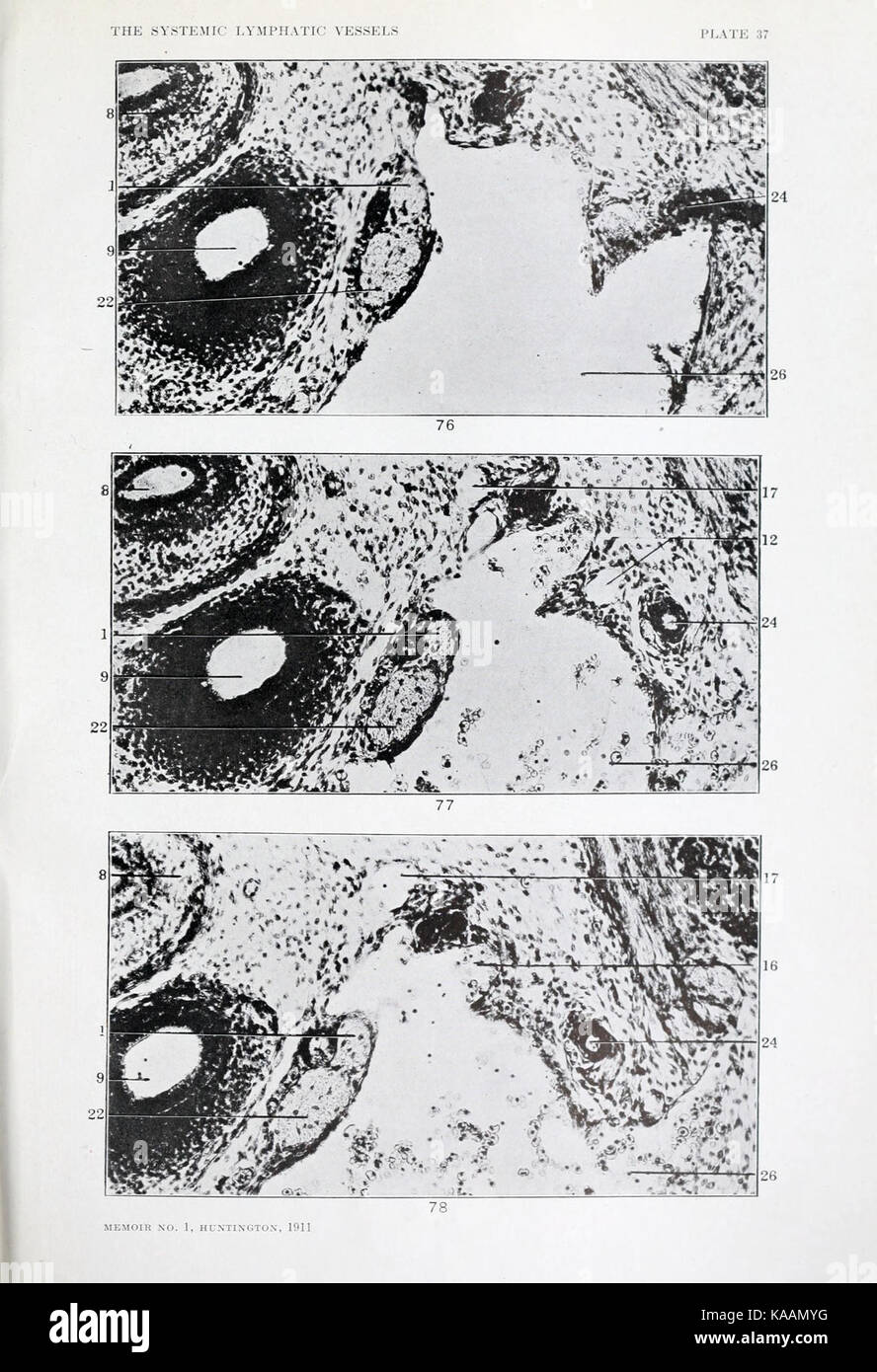 The anatomy and development of the systemic lymphatic vessels in the ...