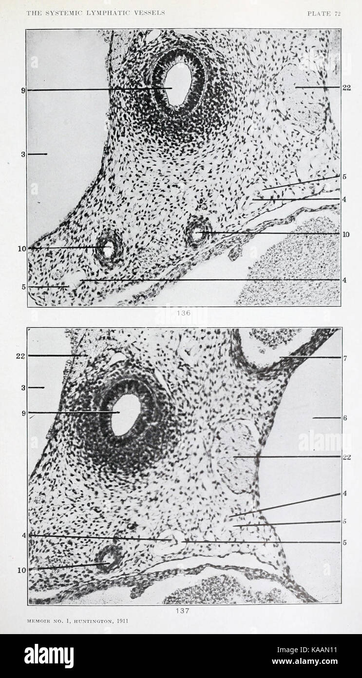 The anatomy and development of the systemic lymphatic vessels in the ...