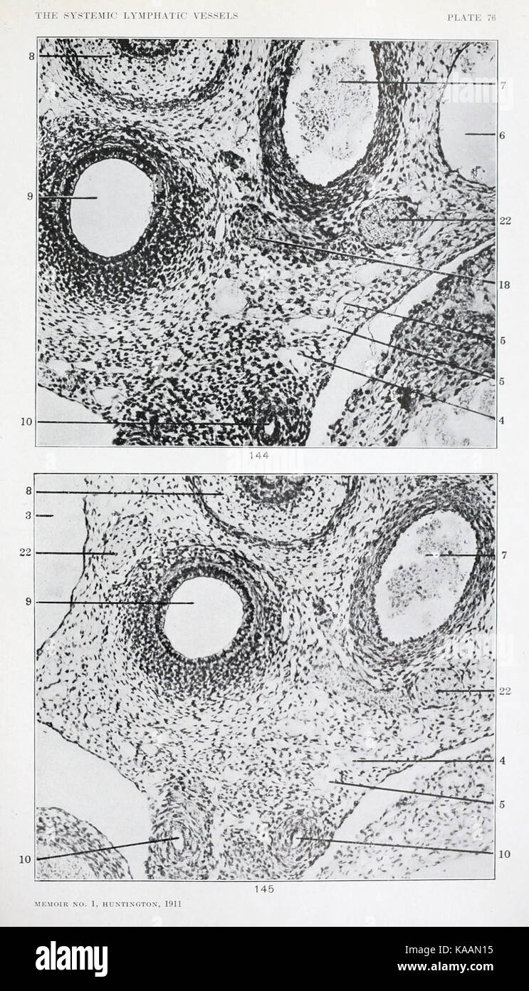 The anatomy and development of the systemic lymphatic vessels in the ...