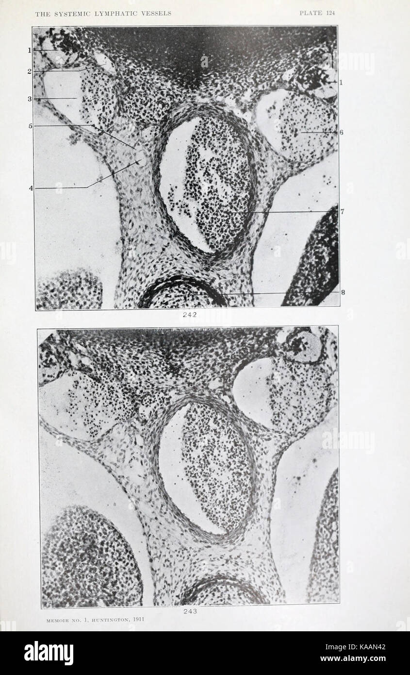 The anatomy and development of the systemic lymphatic vessels in the ...