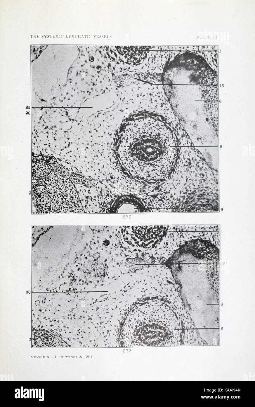The anatomy and development of the systemic lymphatic vessels in the ...