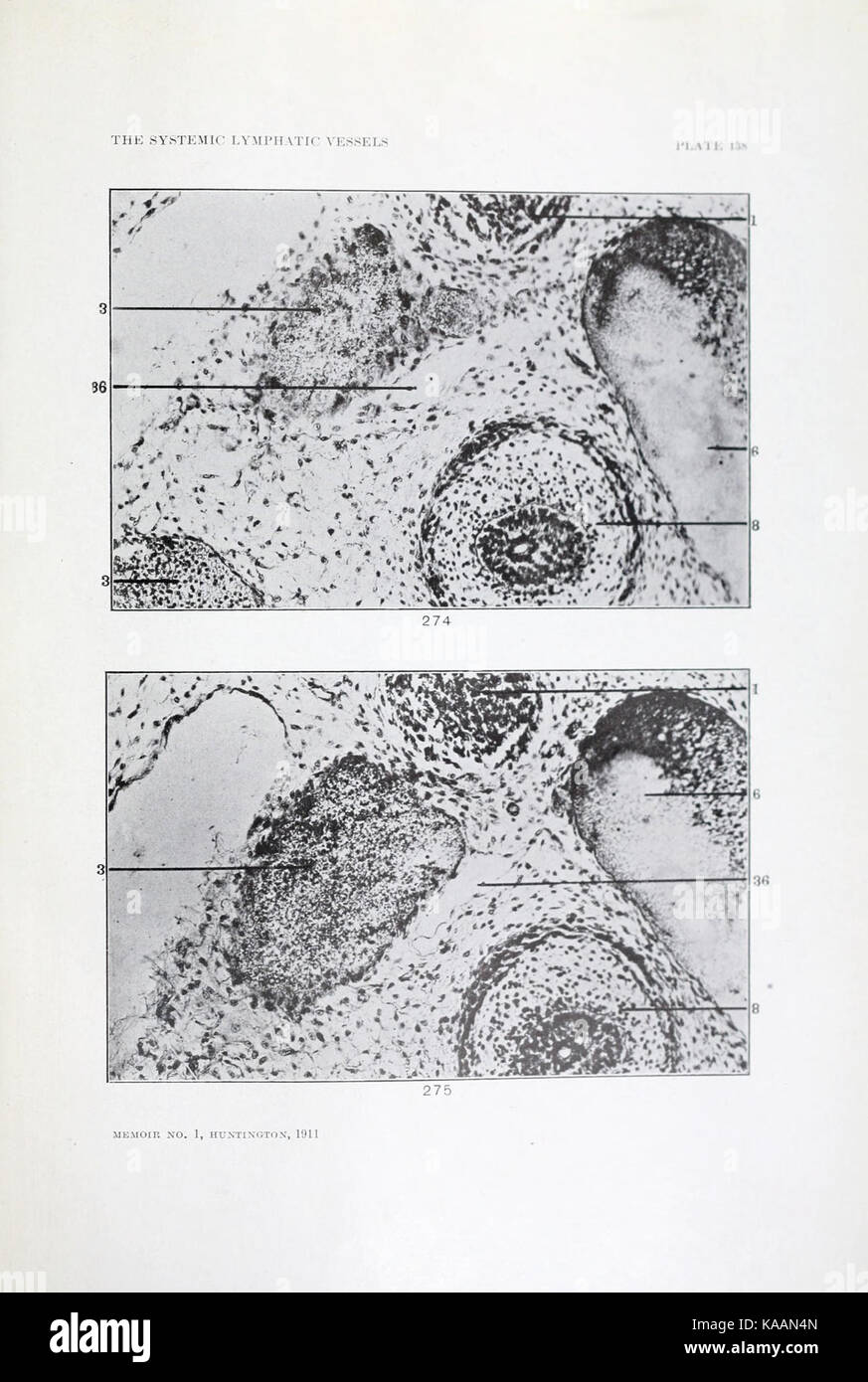 The anatomy and development of the systemic lymphatic vessels in the ...
