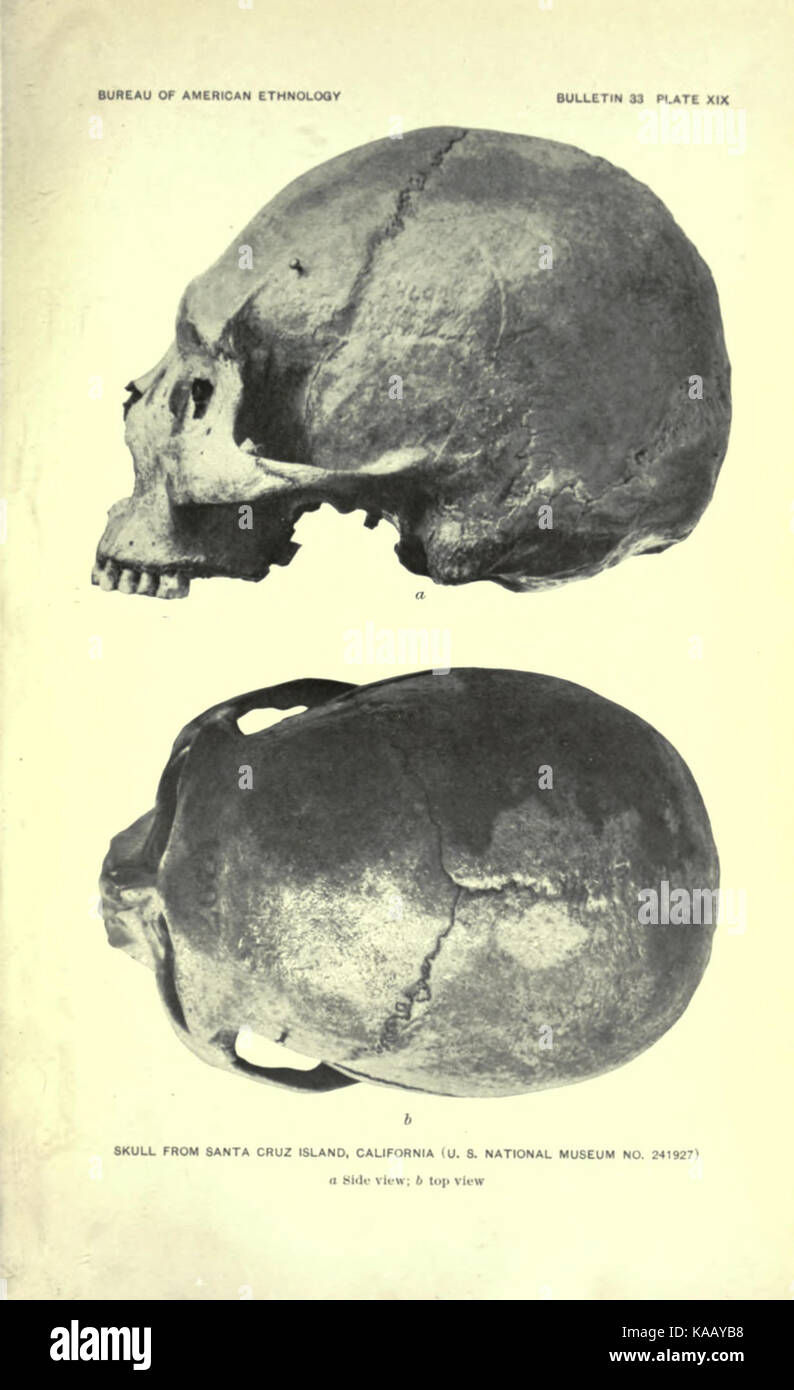 Showcases skeletal remains hi-res stock photography and images - Alamy