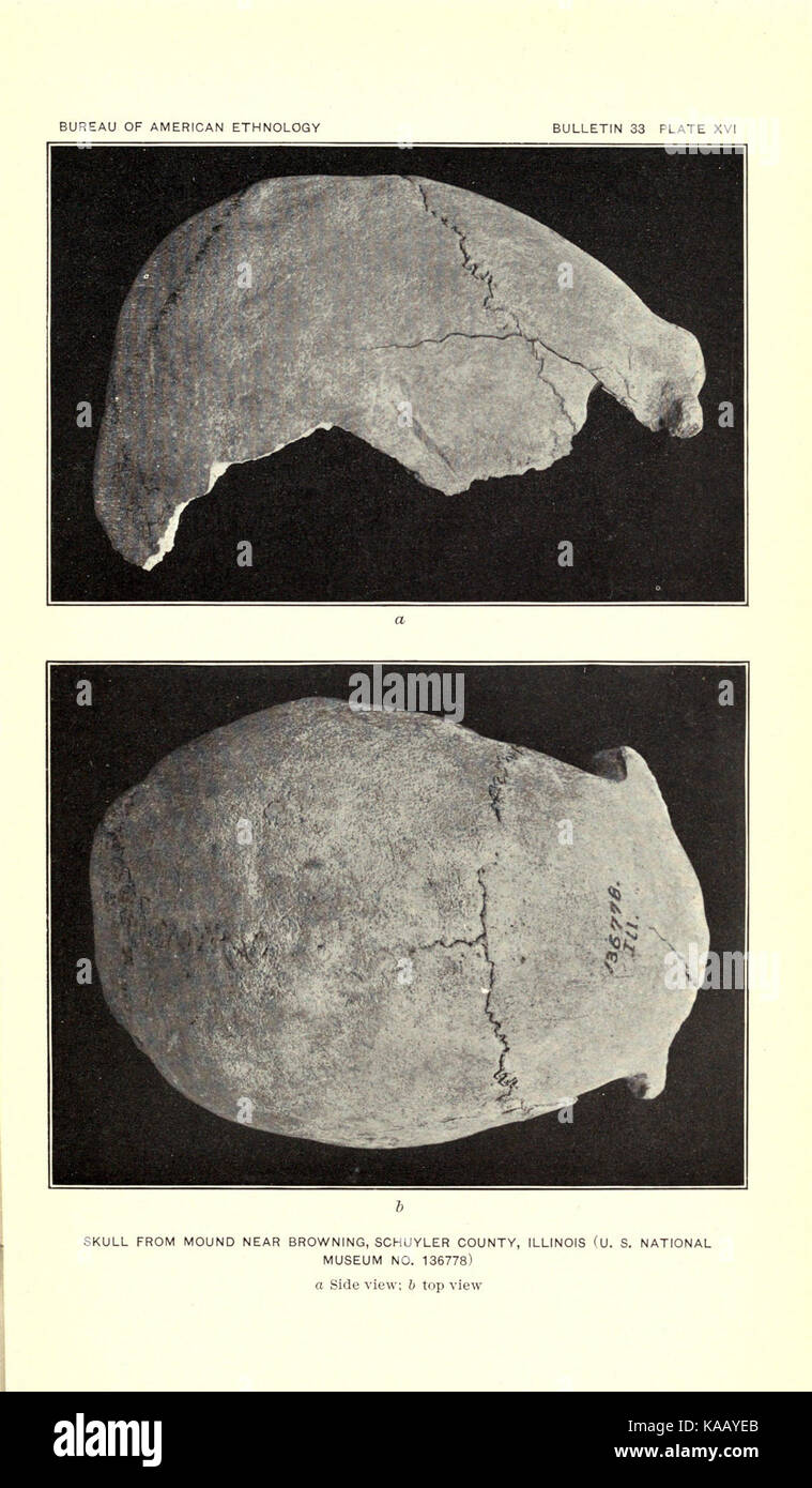 This image depicts skeletal remains, believed to be linked to early ...