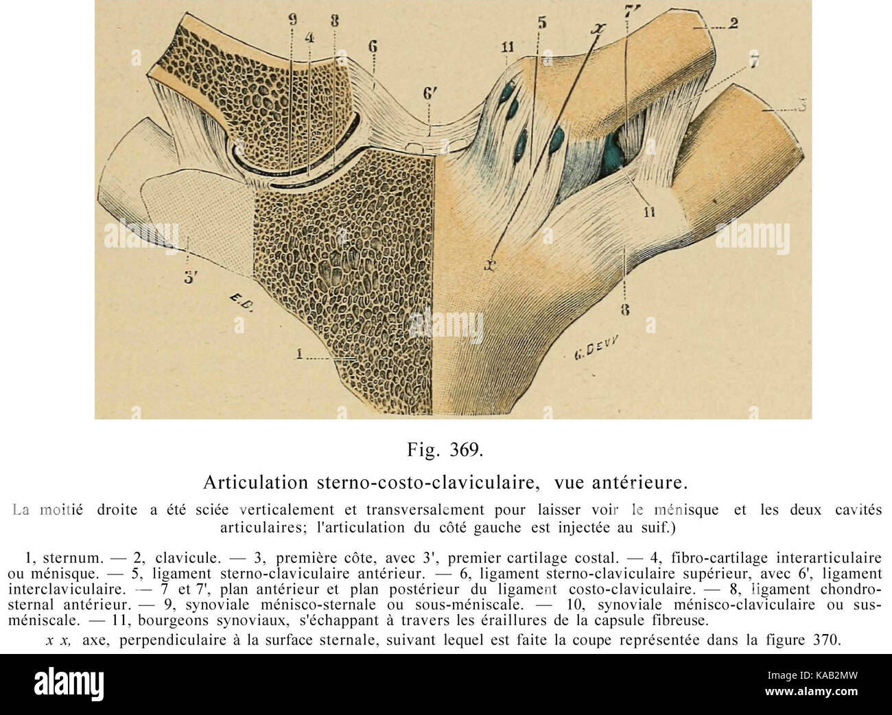 Sternoclavicular Joint Stock Photos & Sternoclavicular Joint Stock ...