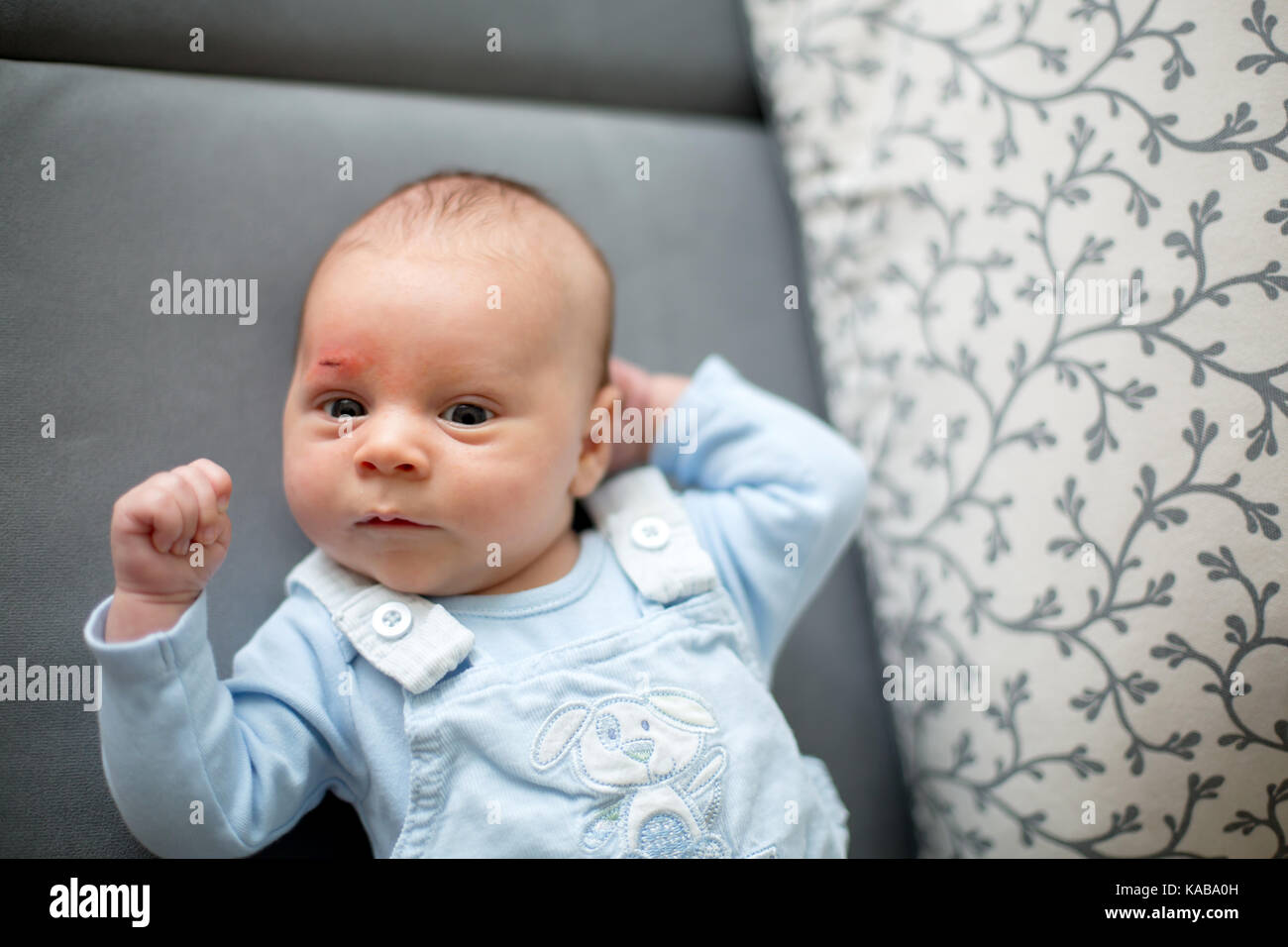 Little newborn baby with little wound on his forehead, scratch Stock ...