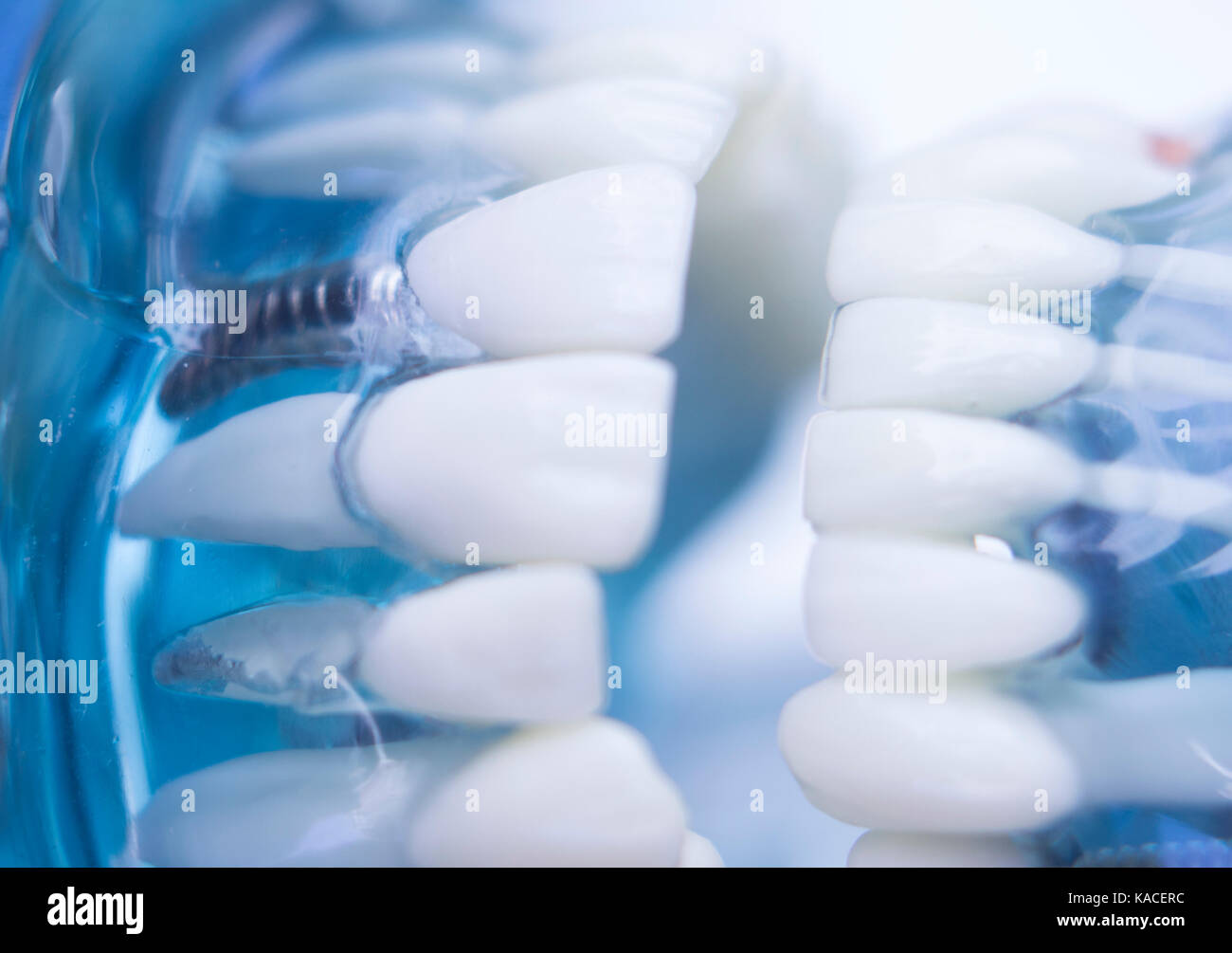 Dentsts dental prosthetic teeth, gums, roots teaching student model ...