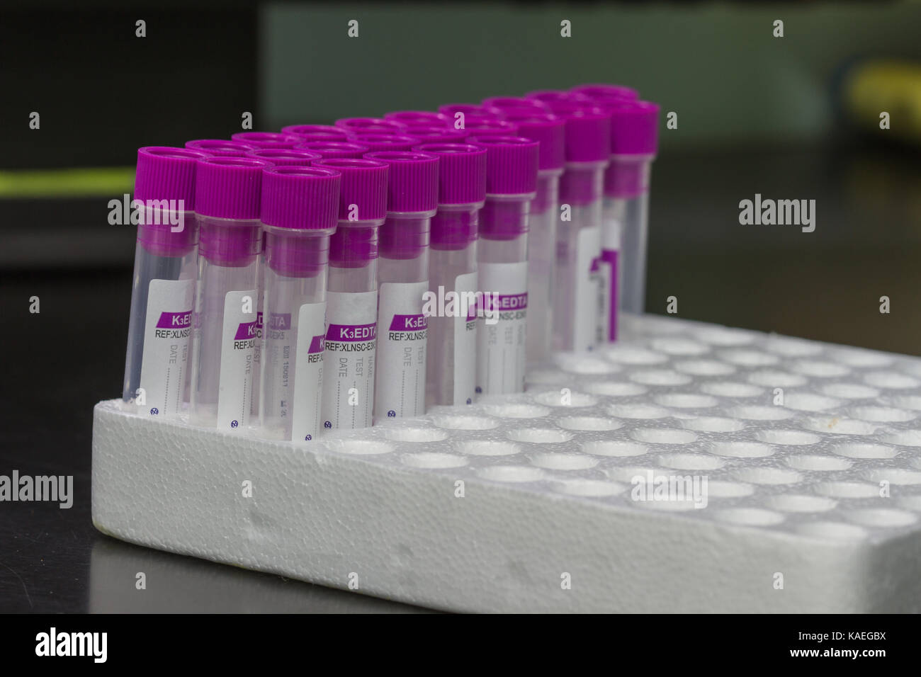 Closeup test tubes with blood for medical and biological analyzes ...