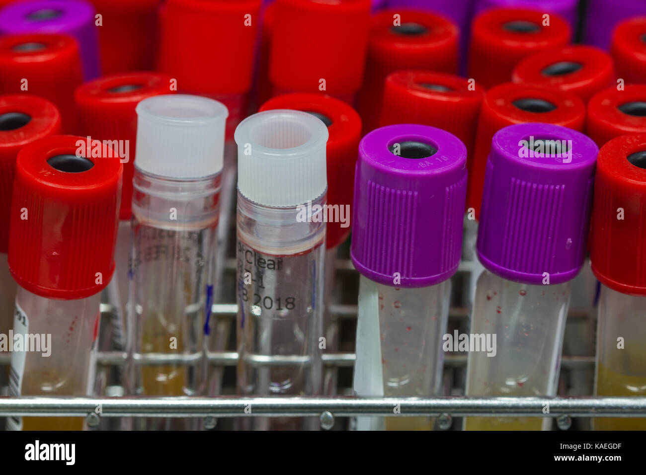 Closeup test tubes with blood for medical and biological analyzes ...