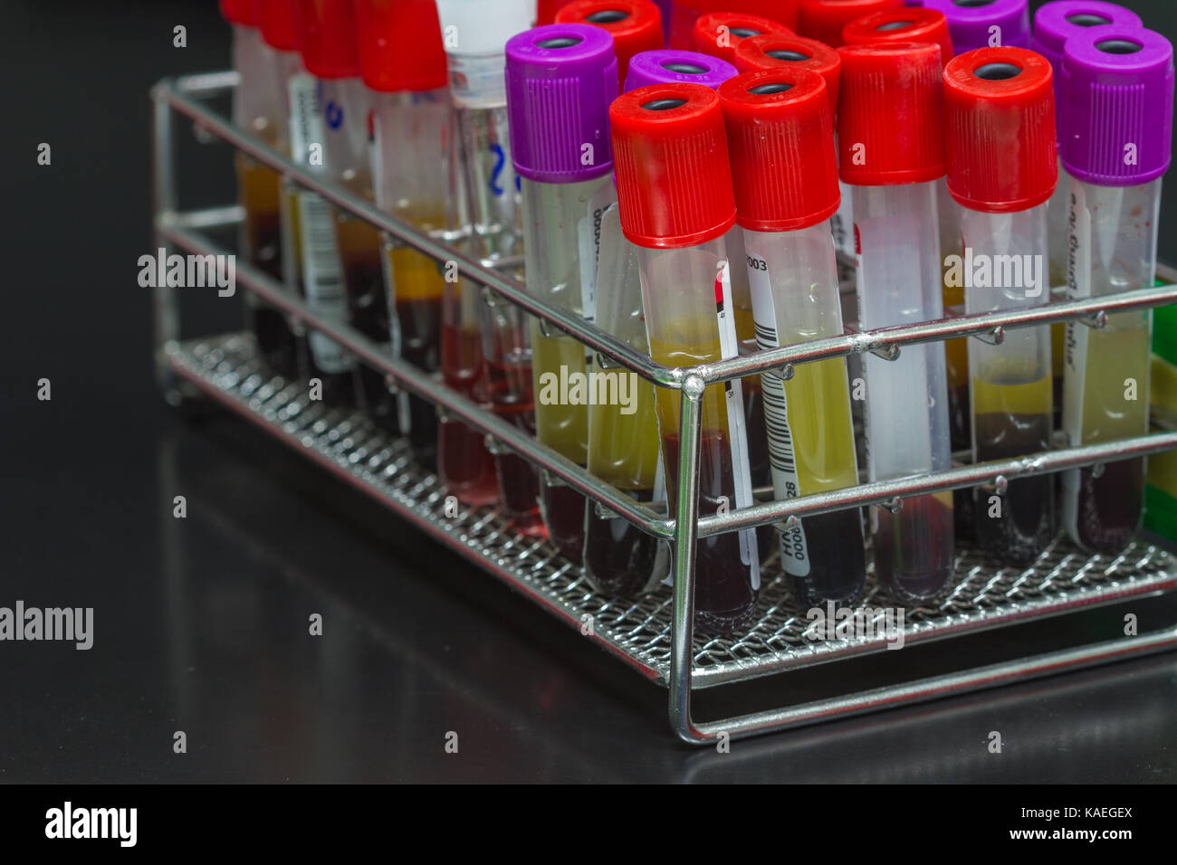Closeup test tubes with blood for medical and biological analyzes ...